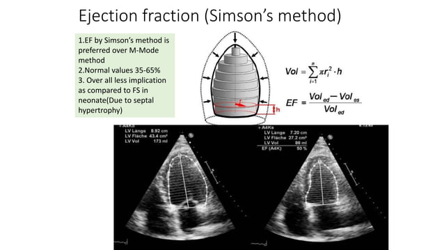 Functional ECHO.pptx