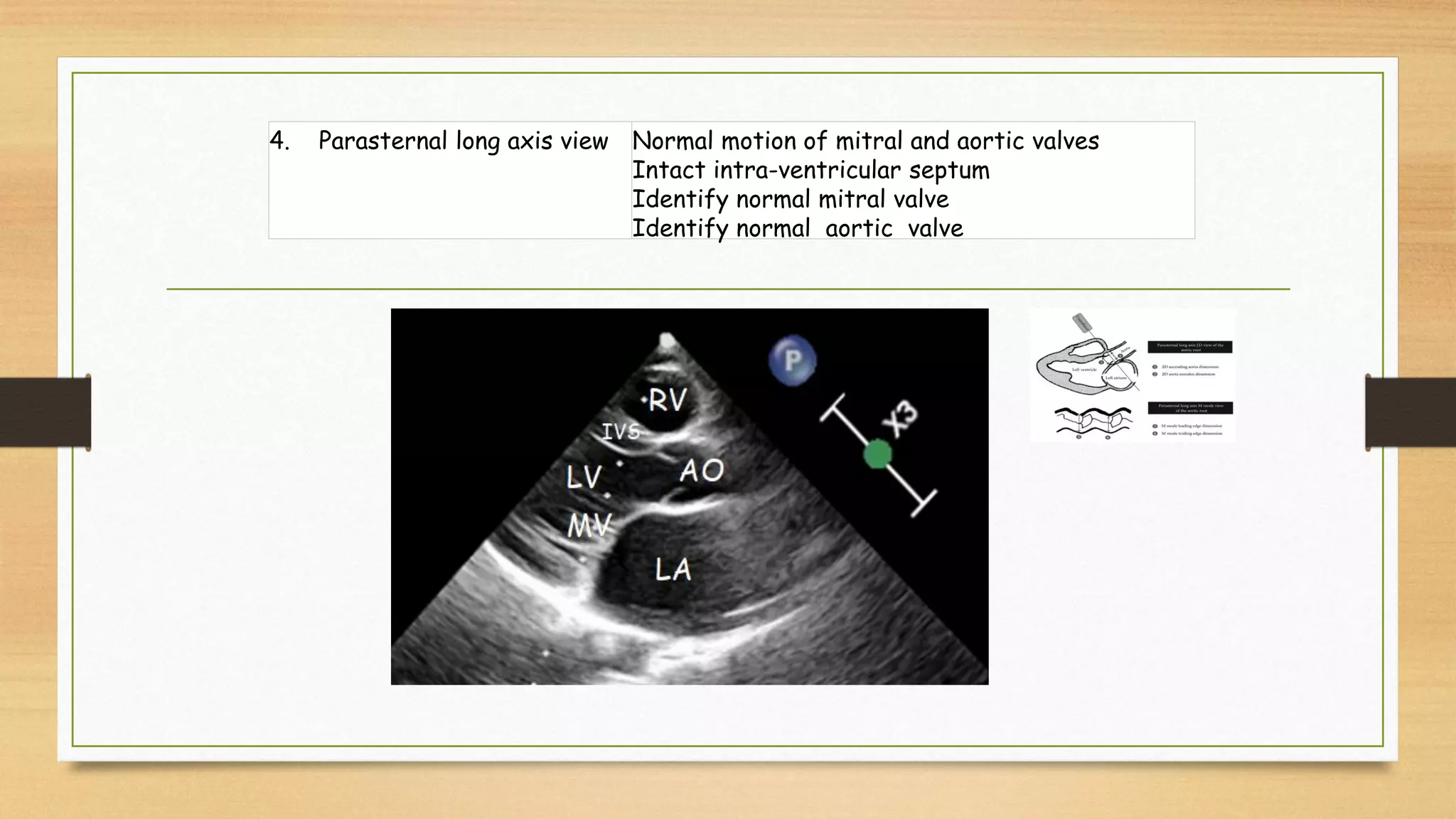 Functional echocardiography ppt | PDF