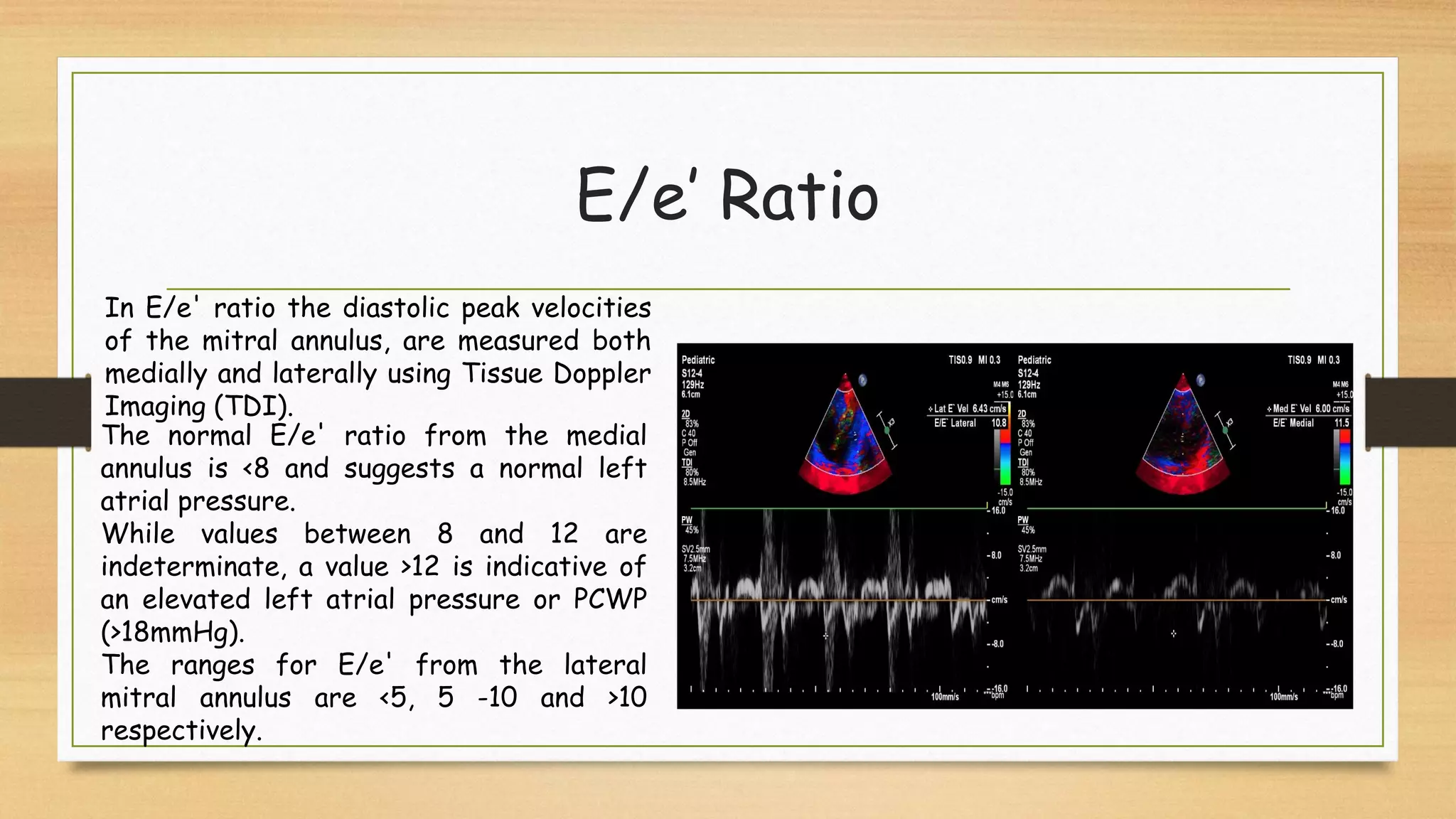 Functional echocardiography ppt | PDF