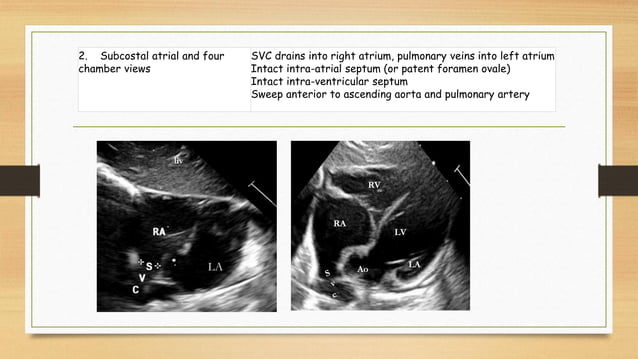 Functional echocardiography ppt | PDF | Heart and Cardiovascular ...
