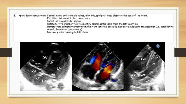Functional echocardiography ppt | PDF | Heart and Cardiovascular Diseases | Diseases and Conditions