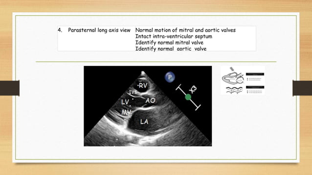 Functional echocardiography ppt | PDF | Heart and Cardiovascular ...