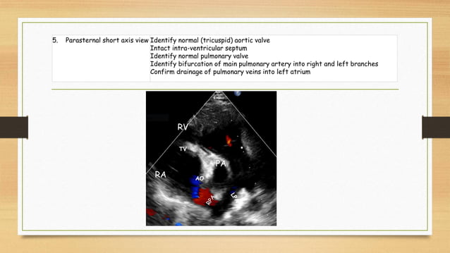 Functional echocardiography ppt | PDF | Heart and Cardiovascular Diseases | Diseases and Conditions