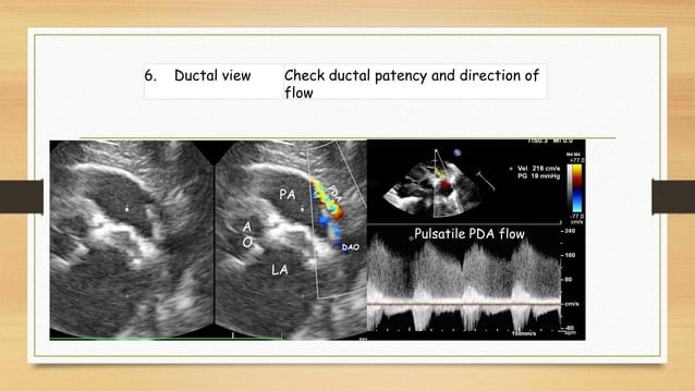 Functional echocardiography ppt | PDF | Heart and Cardiovascular Diseases | Diseases and Conditions
