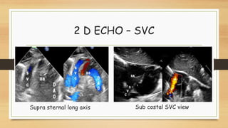 Functional echocardiography ppt | PDF