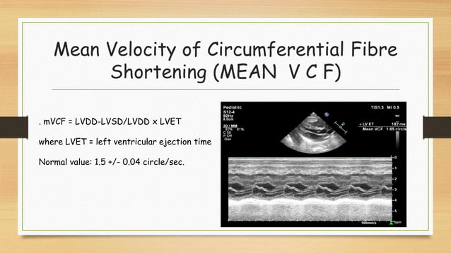 Functional echocardiography ppt | PDF | Heart and Cardiovascular ...
