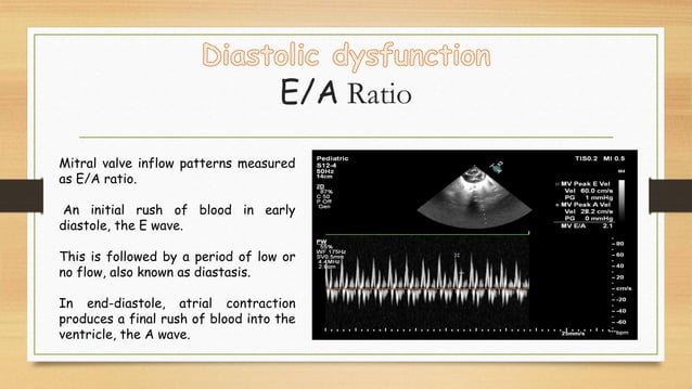 Functional echocardiography ppt | PDF | Heart and Cardiovascular ...