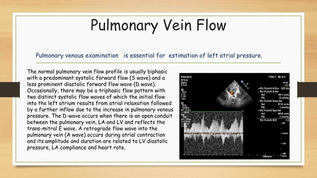 Functional echocardiography ppt | PDF | Heart and Cardiovascular ...