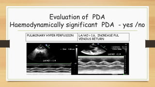Functional echocardiography ppt | PDF