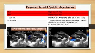 Functional echocardiography ppt | PDF