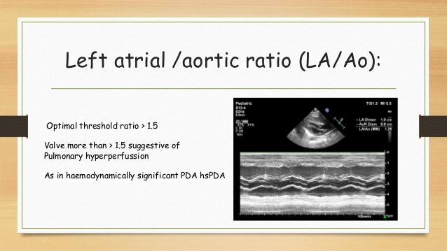 Functional echocardiography ppt