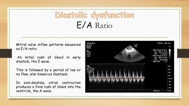 Functional echocardiography ppt