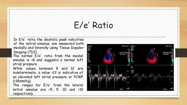Functional echocardiography ppt