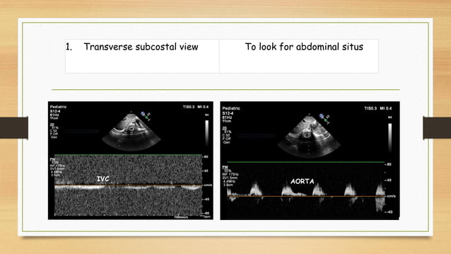 Functional echocardiography ppt nov 2020 | PDF