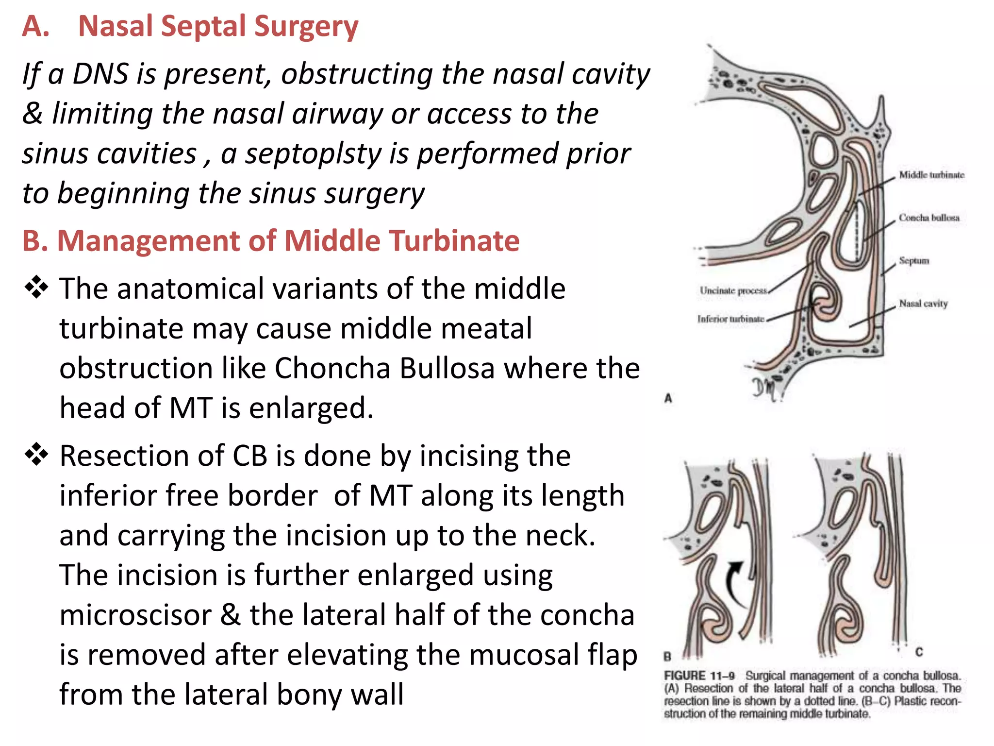 Functional endoscopic sinus surgery | PPTX