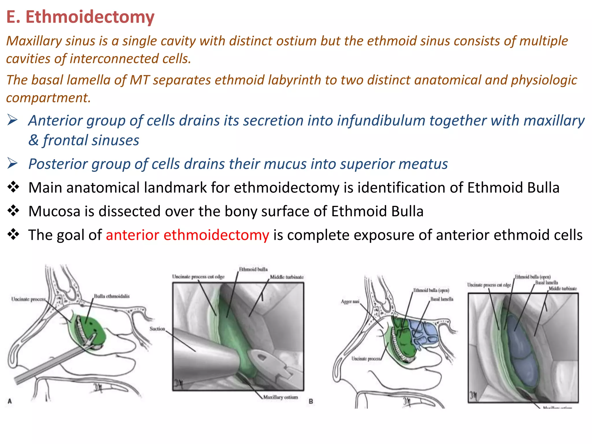 Functional endoscopic sinus surgery | PPTX