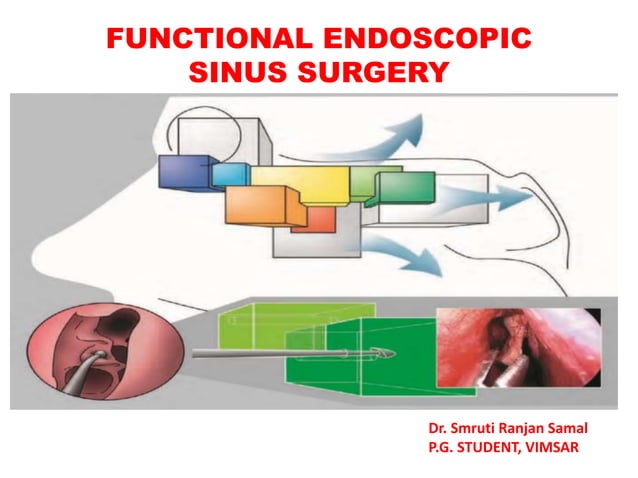 Functional endoscopic sinus surgery | PPTX | Ear, Nose and Throat ...