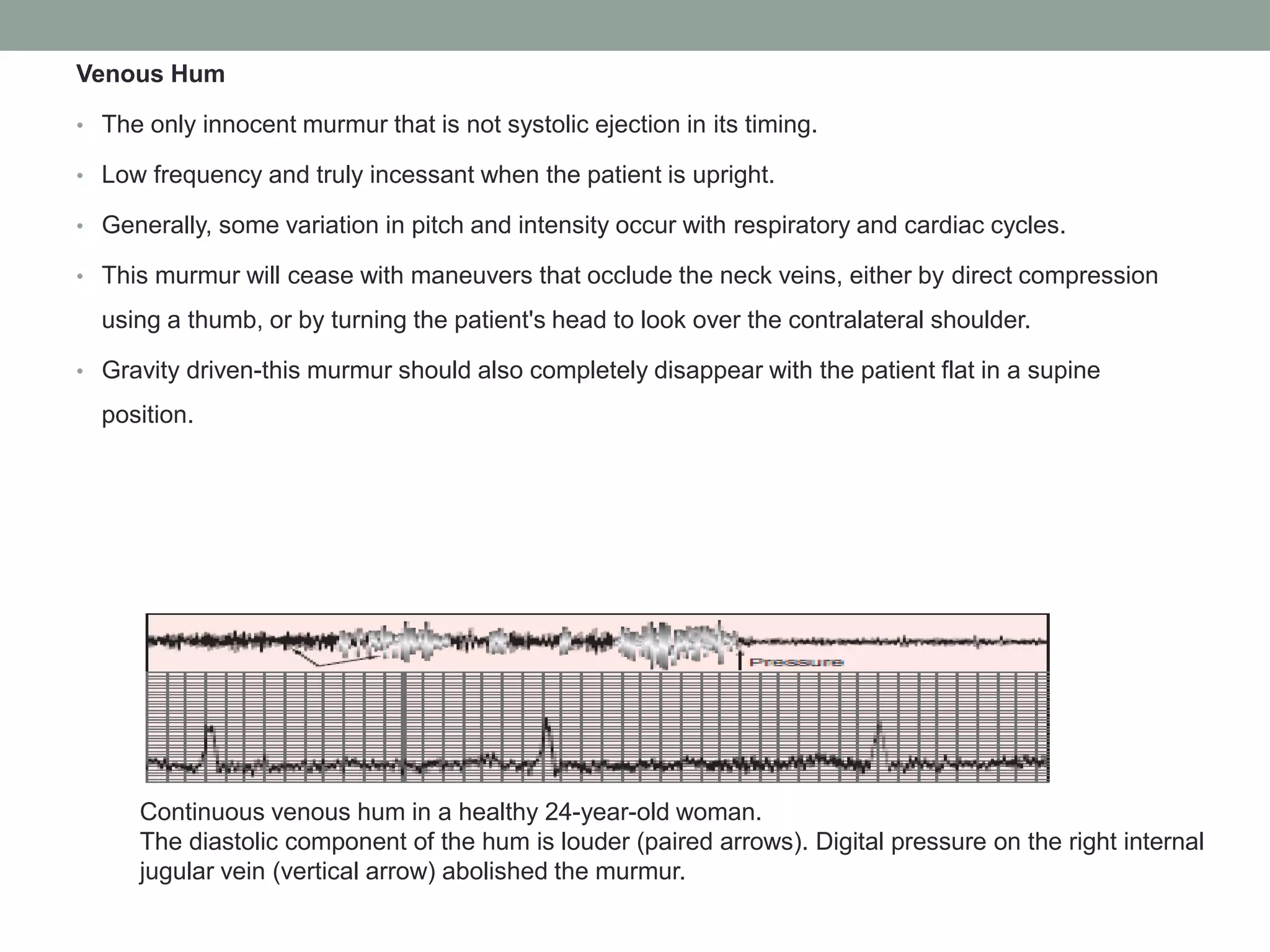 Functional flow murmur | PPTX