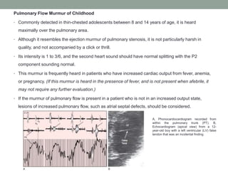 Functional flow murmur | PPTX