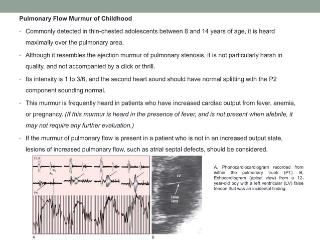 Functional flow murmur | PPTX
