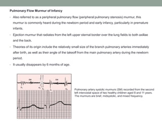 Functional flow murmur | PPTX