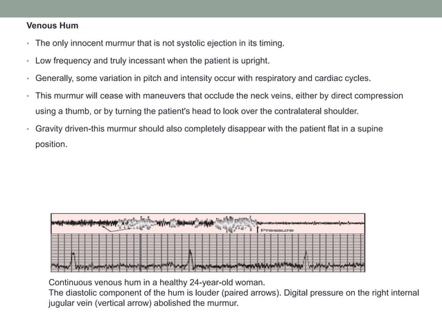Functional flow murmur | PPTX