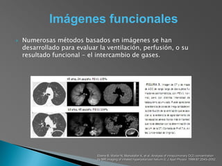 Functional Imaging CT and MRI - Evaluación imagenológica funcional con ...