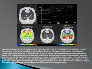 Functional Imaging CT and MRI - Evaluación imagenológica funcional con ...