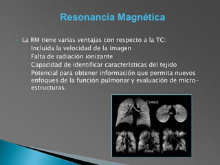 Functional Imaging CT and MRI - Evaluación imagenológica funcional con ...