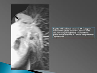 Functional Imaging CT and MRI - Evaluación imagenológica funcional con ...