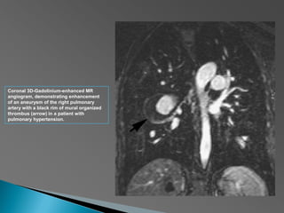 Functional Imaging CT and MRI - Evaluación imagenológica funcional con ...