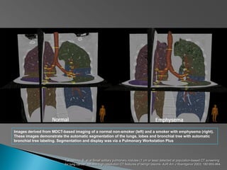 Functional Imaging CT and MRI - Evaluación imagenológica funcional con ...