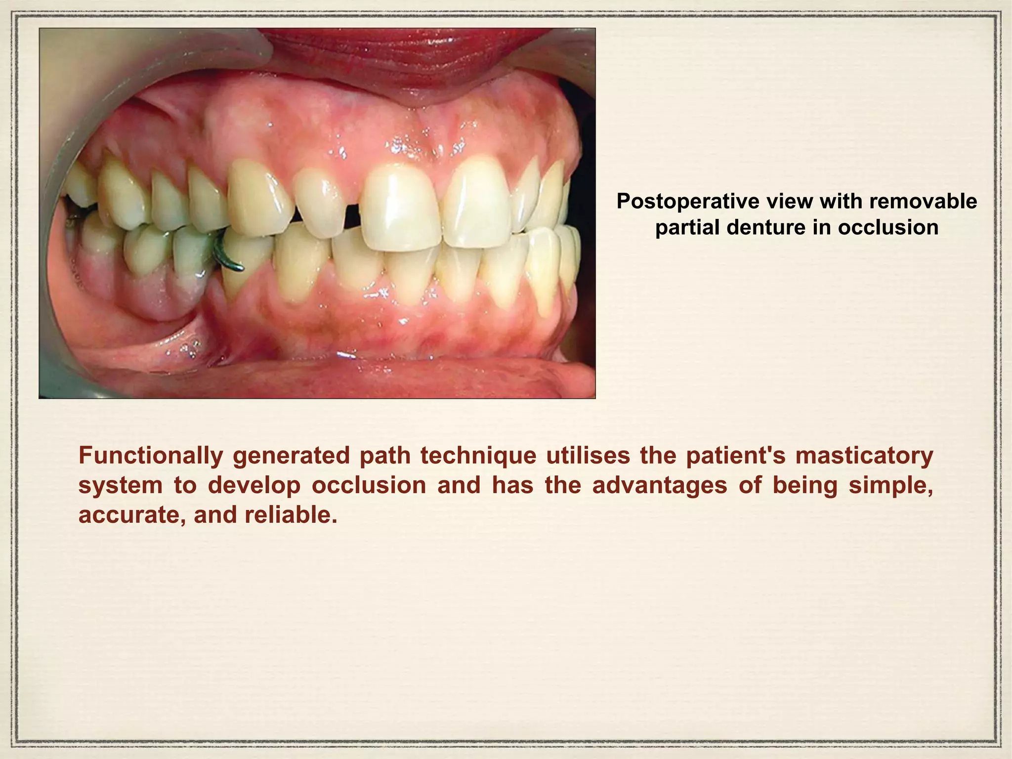 Functionally Generated Pathway | PPTX