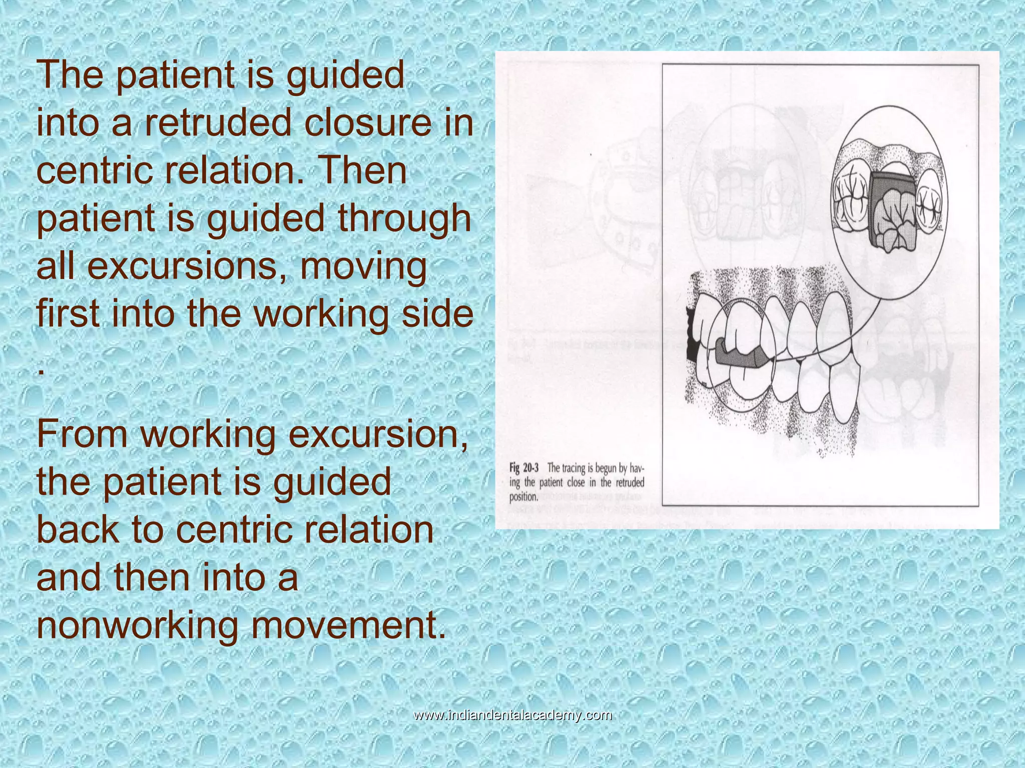 Functionally generated path occlusion final/ cosmetic dentistry ...