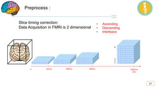 Functional Magnetic Resonance Imaging (FMRI) | PDF