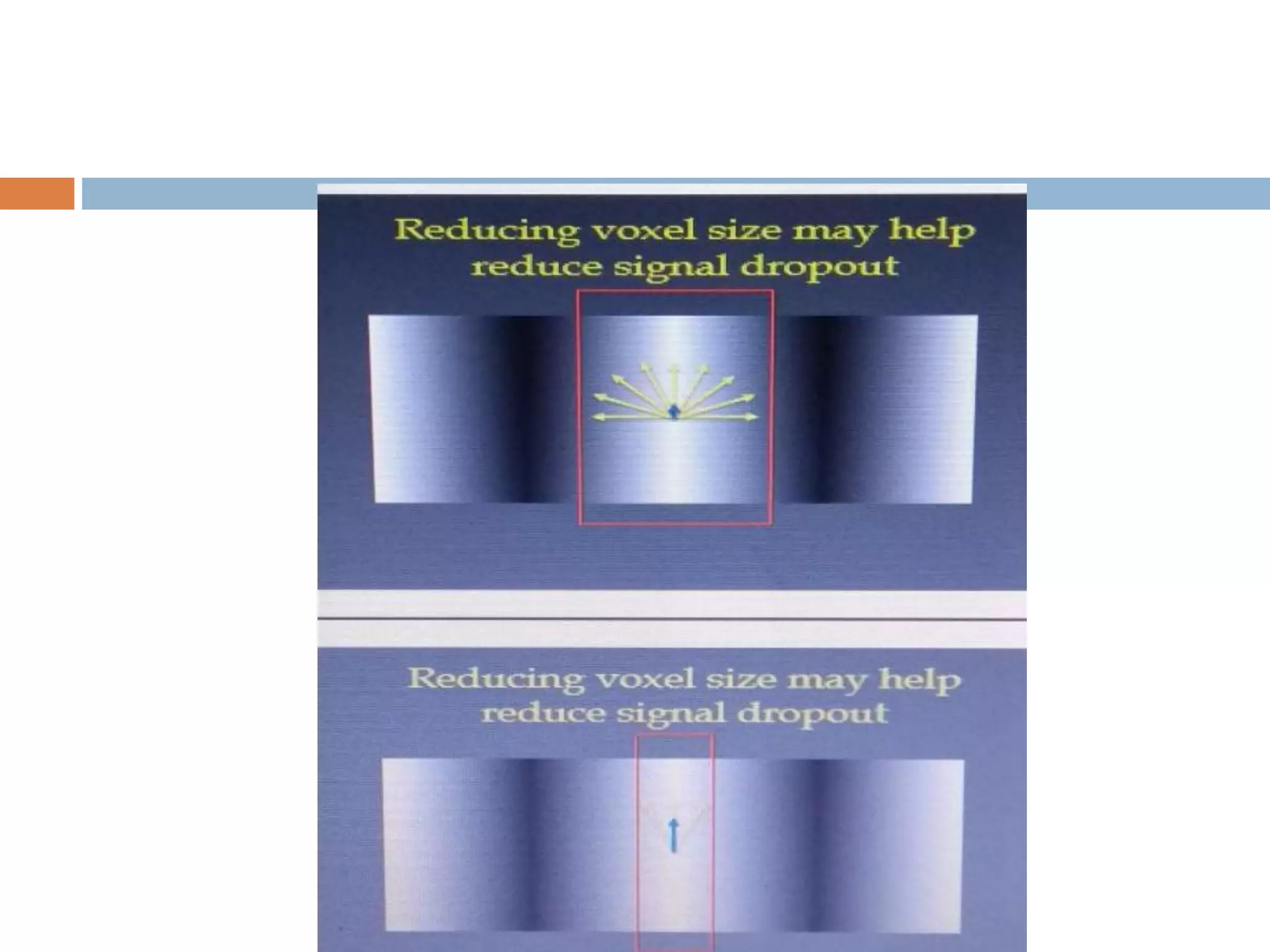 Functional magnetic resonance imaging-fMRI | PPTX