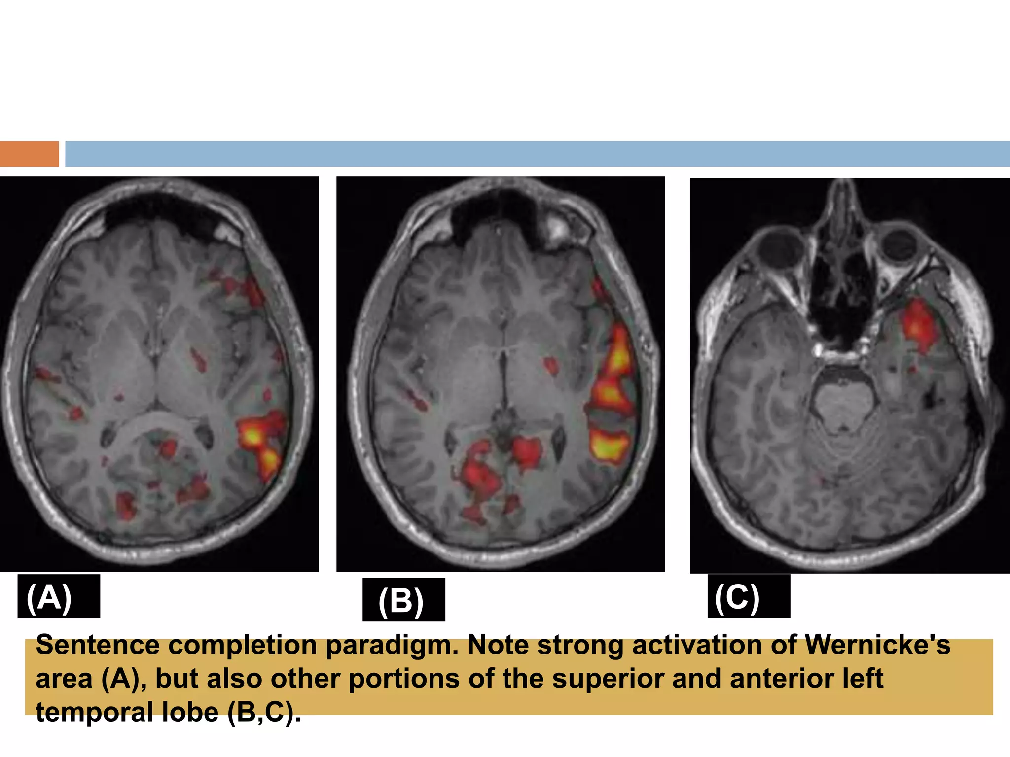 Functional magnetic resonance imaging-fMRI | PPTX