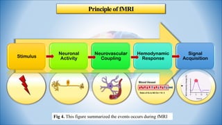 Role of Functional MRI in Neurological disorder | PDF