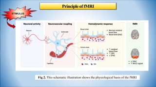 Role of Functional MRI in Neurological disorder | PPT