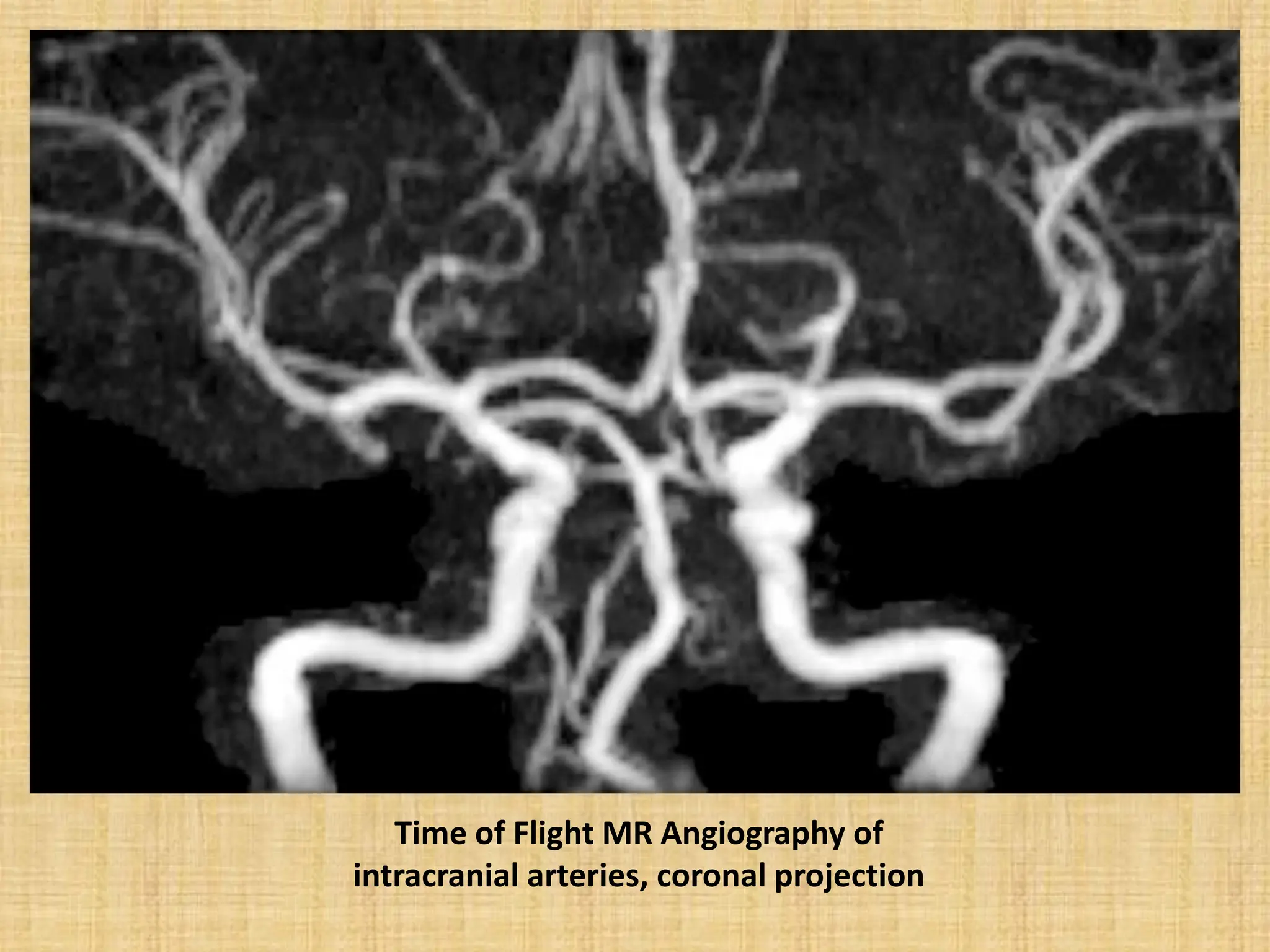 Functional MRI Techniques in modern MRI.pdf