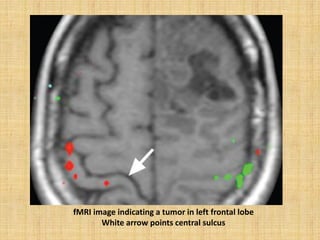 Functional MRI Techniques in modern MRI.pdf
