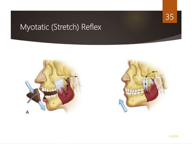 Functional neuroanatomy and physiology of the masticatory system | PPTX ...