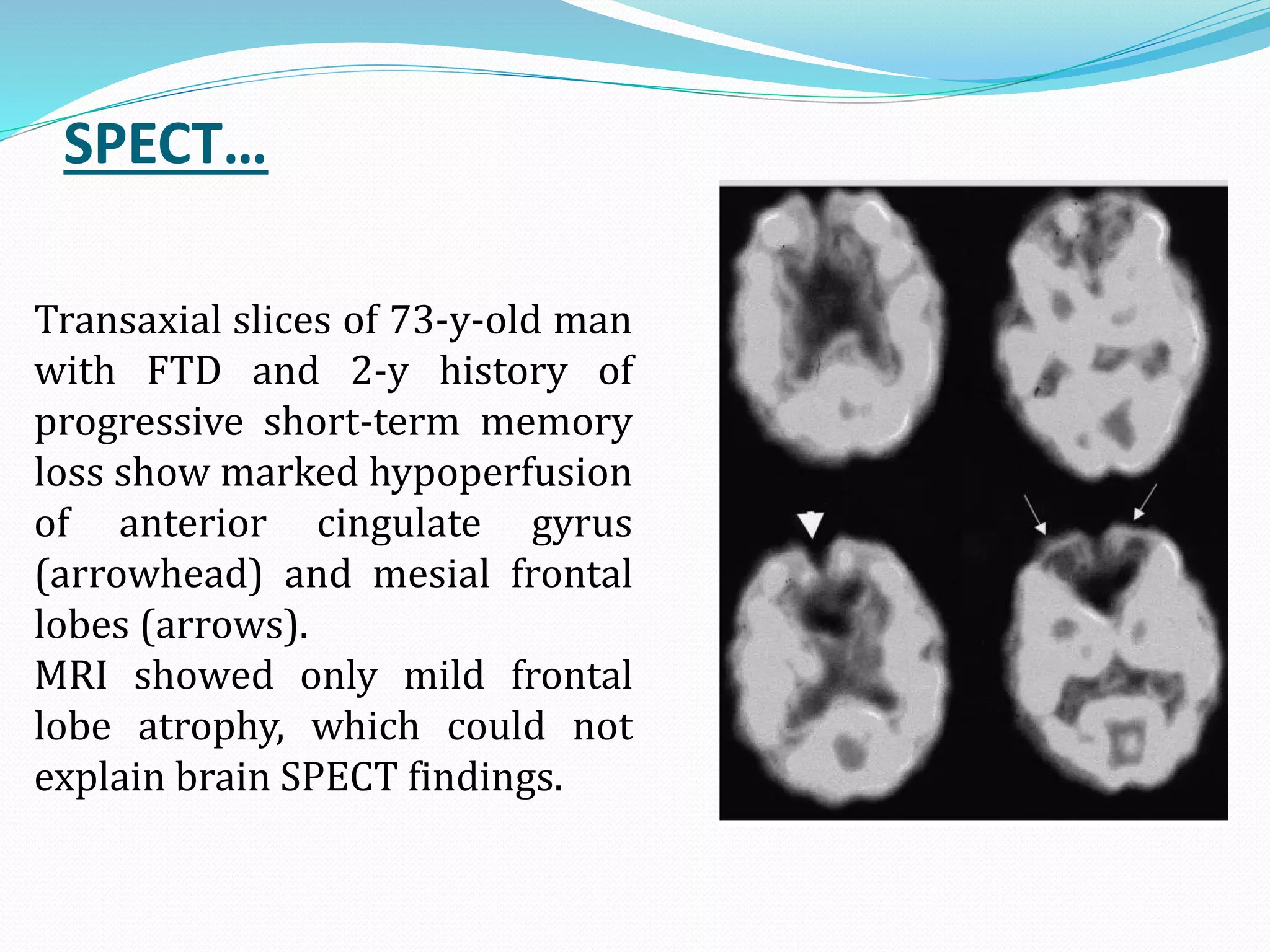 Functional neuroimaging.pptx | PPTX