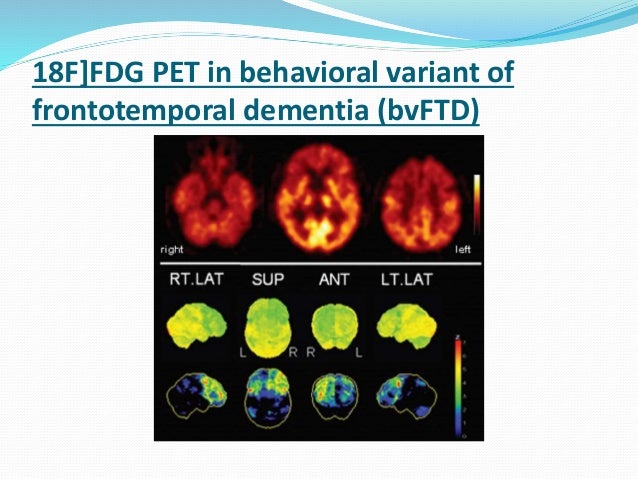 Functional neuroimaging.pptx