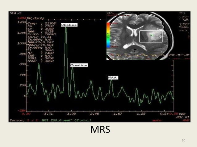 Functional neuroimaging in psychiatry | PPTX