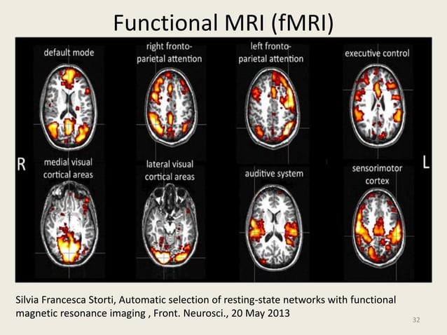 Functional neuroimaging in psychiatry | PPTX