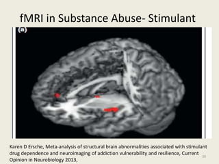 Functional neuroimaging in psychiatry | PPTX