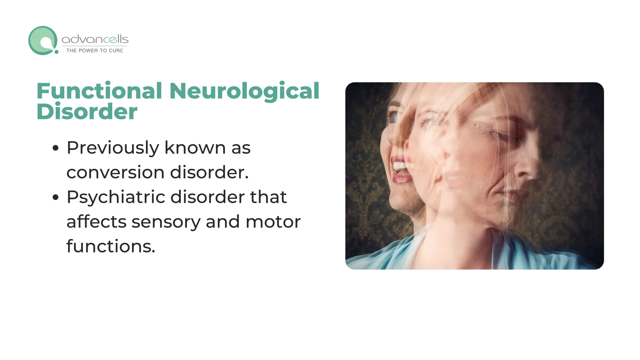 Functional Neurological Disorder: Causes, Diagnosis, and Treatment | PDF