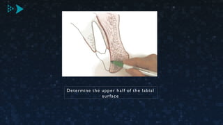 Comprehensive Functional Smile Design: Balancing Aesthetics and ...