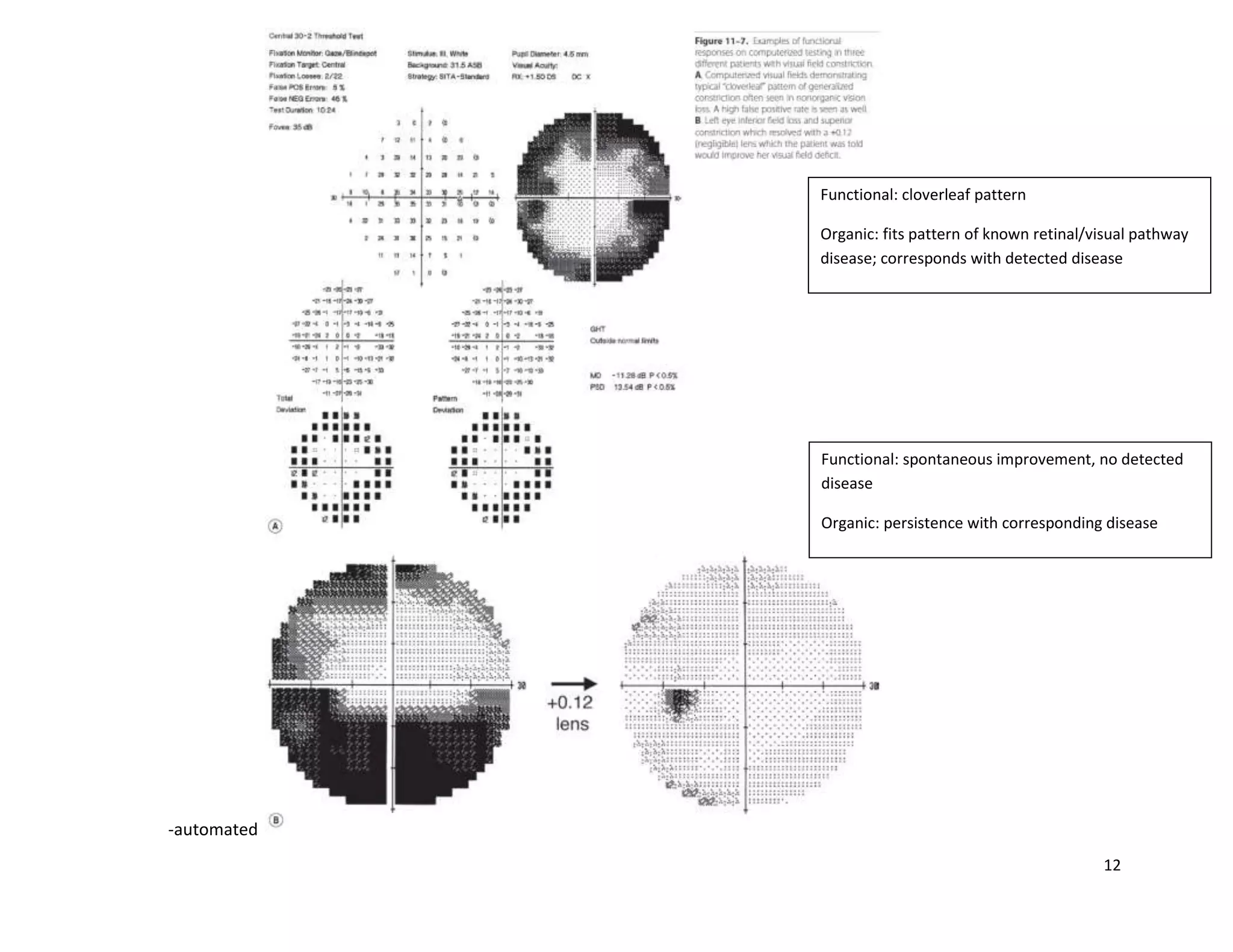 Functional vision loss table 2 | DOCX